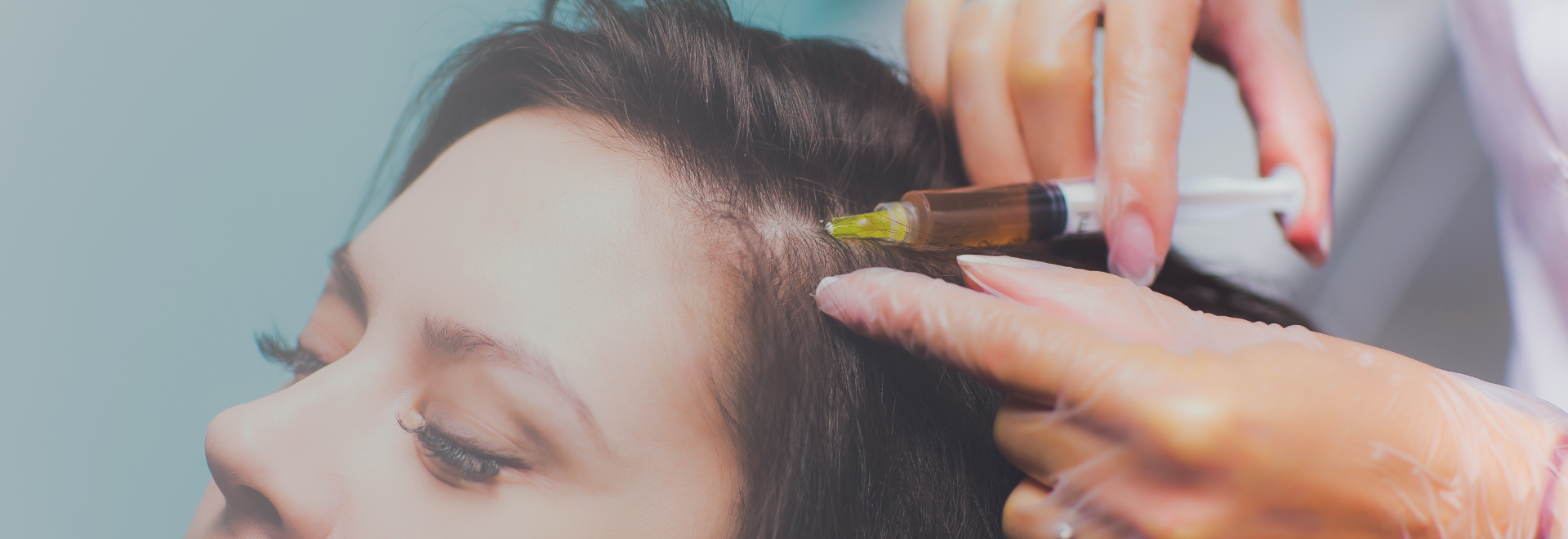 Μεταμόσχευση Μαλλιών Θεσσαλονίκη | Brentas Hair Clinic